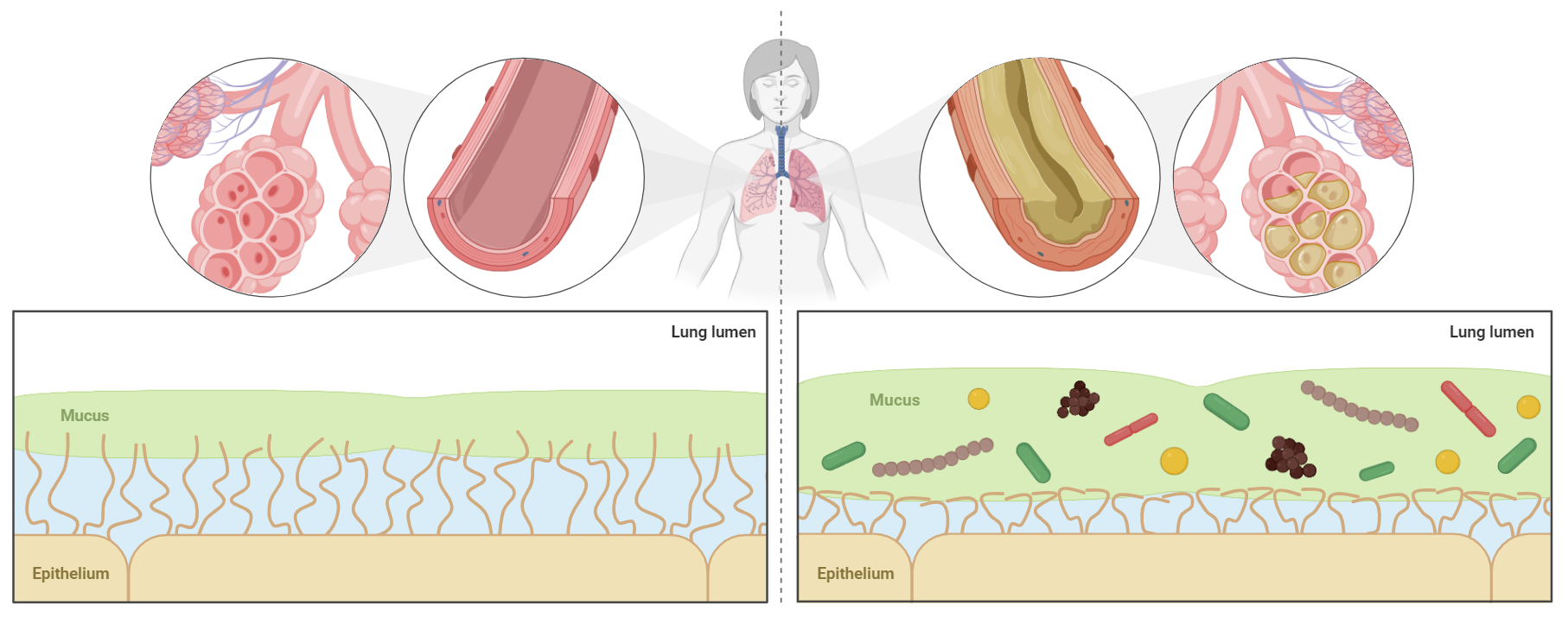 Cftr Channel Animation